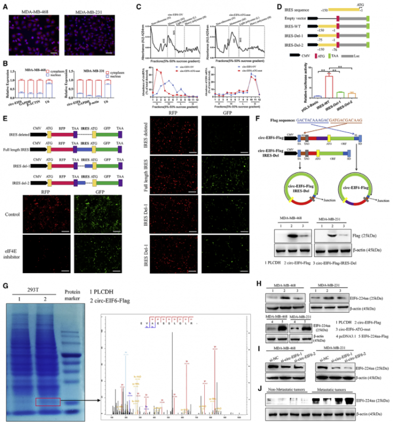 Mol Ther | 蛋白编码环状RNA circ-EIF6通过编码新肽促进三阴性乳腺癌的进展 – circRNA论坛